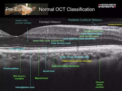 Spectralis Oct Normal Anatomy And Systematic Interpretation Pdf
