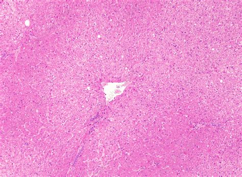 Human Liver Tissue Light Micrograph Stock Image C0606860