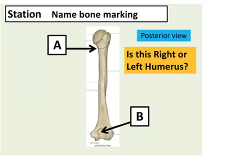 Difference Between Right And Left Humerus