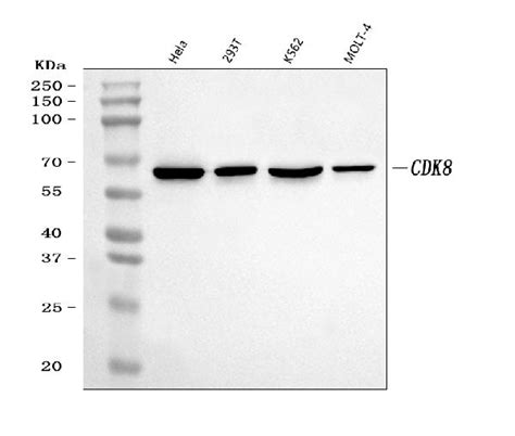 Anti-CDK8 Antibody Picoband™ | Bosterbio