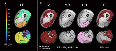 Qmri Data In Low Fat Muscles Overview Of Mean Fat Fractions Of All