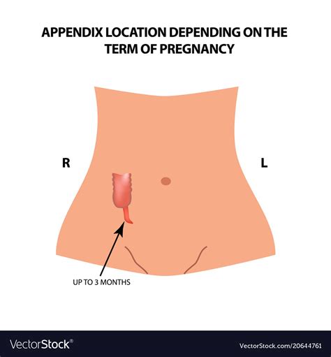 Appendix Depends On The Term Pregnancy Months Vector Image
