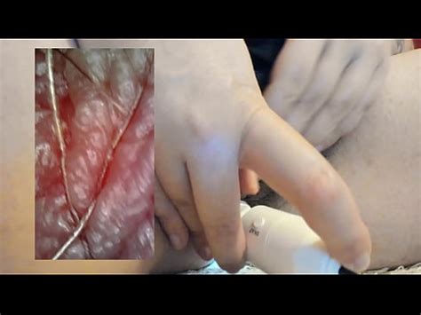 Extreme Vore Compilation Extreme Vaginal Endoscopy Orgasm Xvideos Com