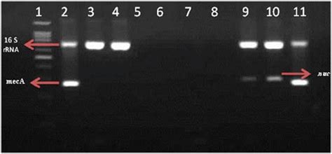 Triplex Pcr Of S Aureus And Determination Of Methicillin Resistance Download Scientific