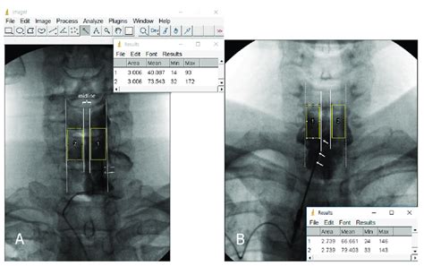 The Grayscale Brightness Results Of Rectangular Region Of Interest