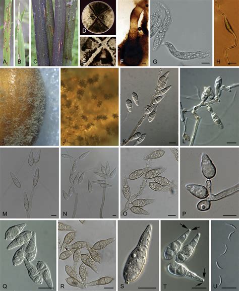 Pyricularia Spp A C Leaf Spots Of Rice Caused By Pyricularia Oryzae