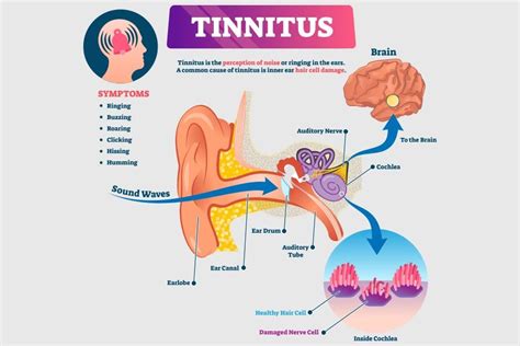 What Is The Fastest Way To Cure Tinnitus