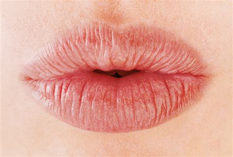 Why Are My Lips Chapped After Drinking Water Sitelip Org