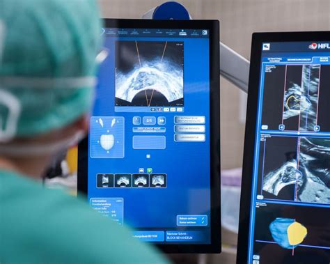 Hifu Therapy For Prostate Cancer How Patients Are Doing After Three Years Usz