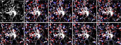 Cortical Two Photon Imaging On Awake Mouse Resting Microglia Are Download Scientific Diagram