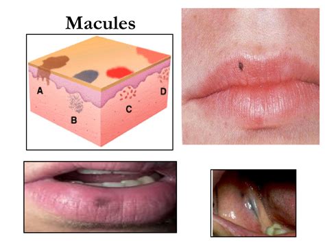 SOLUTION Pictures For Lesions Terminology Studypool