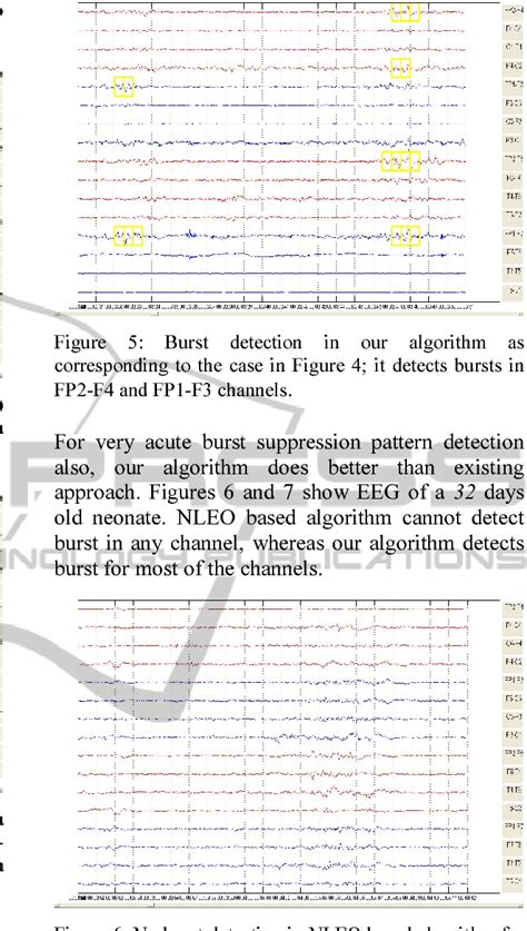 Figure 5 From Automated Burst Detection In Neonatal Eeg Semantic Scholar