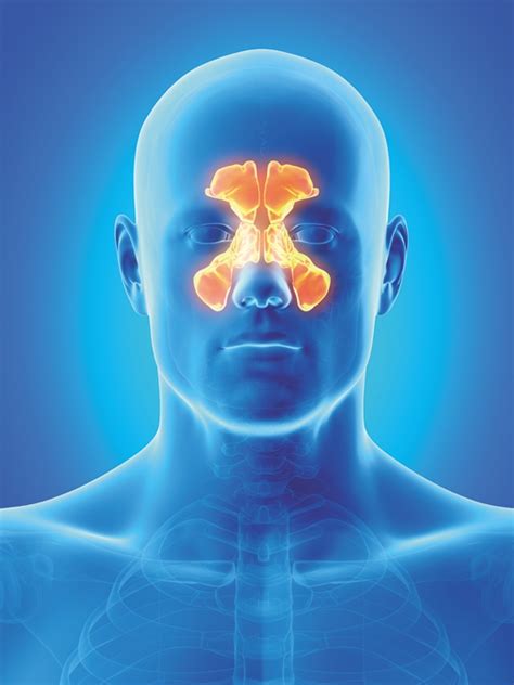 Rhinosinusitis Acute Bacterial Signs And Symptoms Mims Malaysia