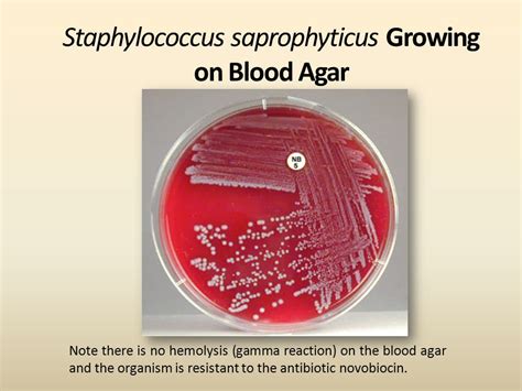 Staphylococcus Saprophyticus Microbiology Medbullets
