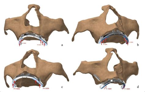 Occlusal Forces On Posterior Region Of Each Group The Total Occlusal Download Scientific