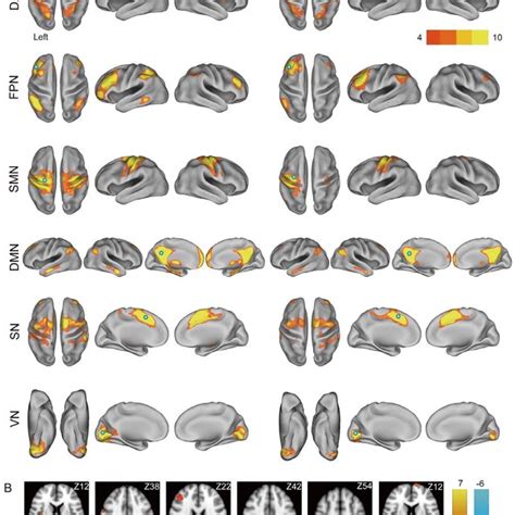Comparisons Of Six Resting State Functional Networks Between Healthy Download Scientific