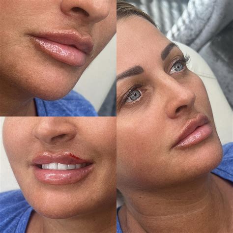 Wentvalley Skips Limited Love Our Prices This Valentines Weve Got