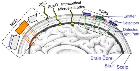 State Of The Art On Brain Computer Interface Technology Pmc