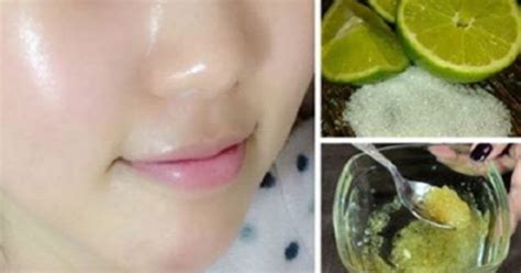 Use Lemon To Remove The Spots From Your Face TOP 5 DIY