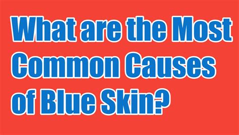 English Teacher What Are The Most Common Causes Of Blue Skin