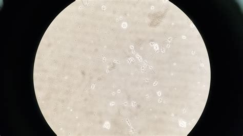 Can Anyone Advise On Opc Culture Issues Cell Debris And Low