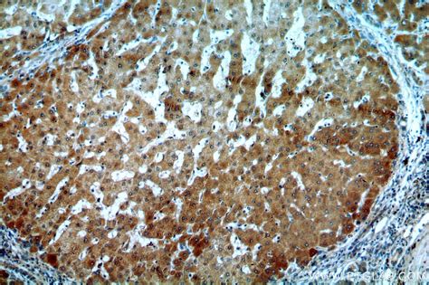 Tspan33 Antibody 14329 1 Ap Proteintech