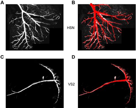 Model Based Reconstruction Of Neuronal Branching From 3d Two Photon