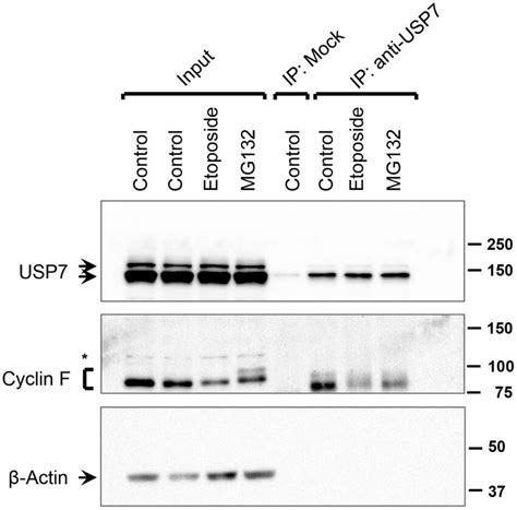 Interaction Between Usp7 And Cyclin F Under Dna Damaging Condition