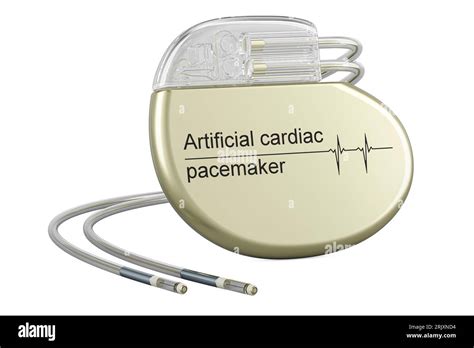 Artificial Cardiac Pacemaker Artificial Pacemaker 3d Rendering Isolated On White Background