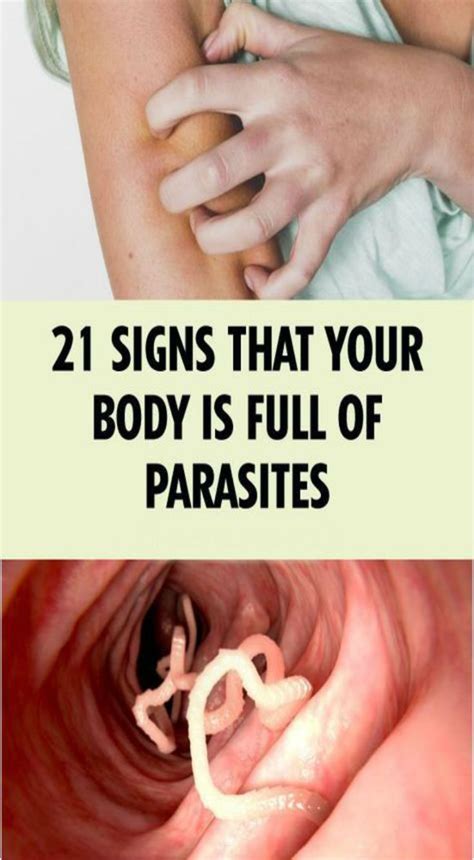 Signs That Your Body Is Full Of Parasites Daily Rumors Intestinal Parasites Parasite Health