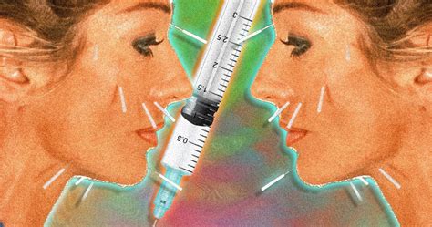 Is Cosmetic Acupuncture A Cheap Alternative To Botox