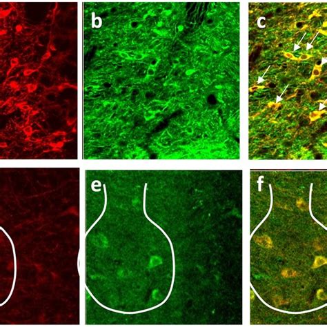 In Depth Fiber Optic Optogenetic Stimulation Using Single Blue Vs Download Scientific Diagram