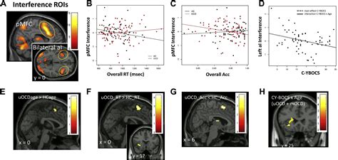 Development Of Posterior Medial Frontal Cortex Function In Pediatric Obsessive Compulsive