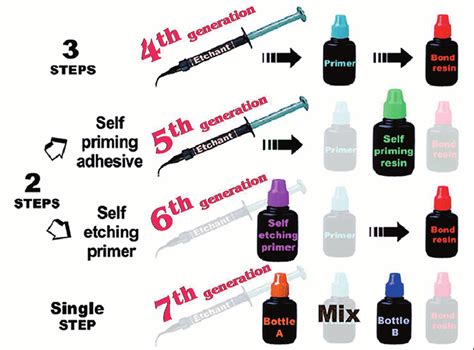 Classification Of Contemporary Adhesives Into 3 Step Total Etch 2 Step