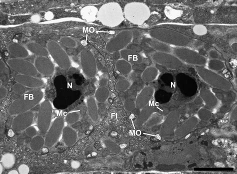 Ditylenchus Arachis Immature Spermatozoa In Male Testis Tem Download Scientific Diagram