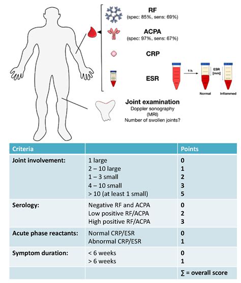 Rheumatoid Arthritis Diagnosis