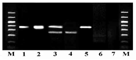 Determination Of Bcr Abl Fusion Transcript Product Obtained By Download Scientific Diagram