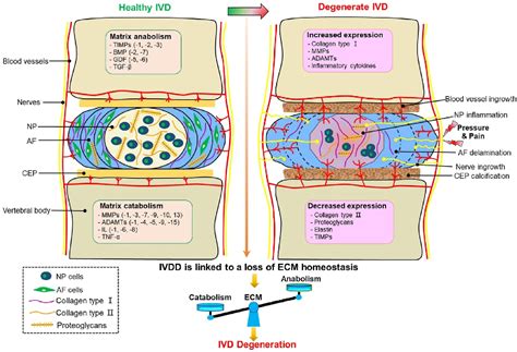 Figure From Multiple Nano Drug Delivery Systems For Intervertebral Disc Degeneration Current