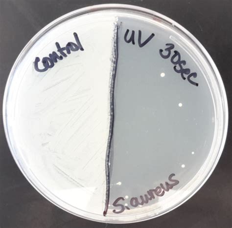 Effect Of Uv Light On Bacterial Growth Flashcards Quizlet