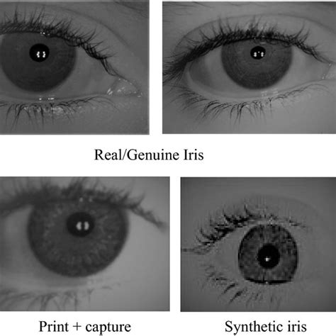 A Inner Iris Circle Fitted Image B Segmented Iris Image