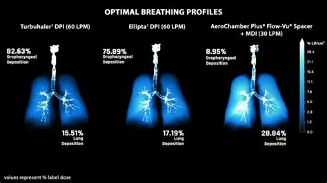 Dry Powder Inhalers Dpis Vs Metered Dose Inhaler Mdi With Valved Spacer Using Functional