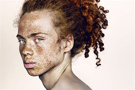 London Photographer Celebrates The Beauty Of Freckles With Stunning