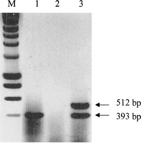 Pcr Amplification Nested Pcr Of Proviral Dna Dnas Were Isolated Download Scientific Diagram