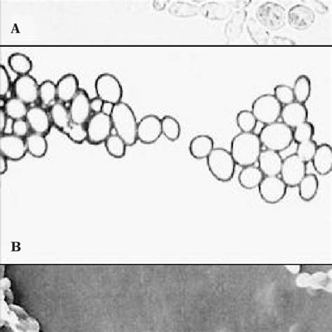 Micromorphology Of The Vaginal Yeast Isolates A Pseudohyphal Growth Download Scientific
