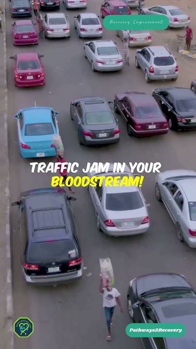 Understanding Hyperlipidemia Ii Causes Risks And Management Youtube