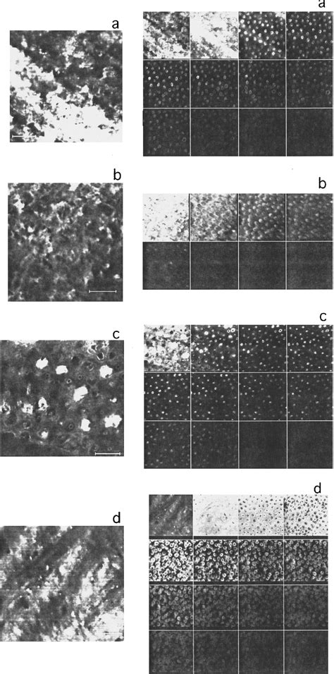 Figure 2 From Visualization And Quantification Of Dentin Structure Using Confocal Laser Scanning