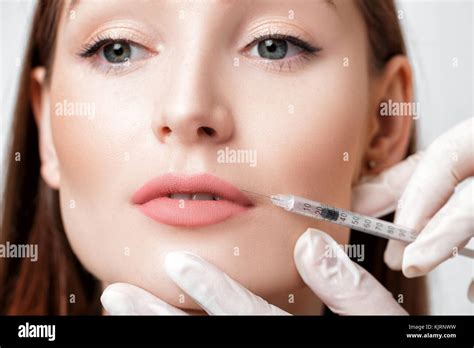 Woman Getting Injection On Lips Stock Photo Alamy