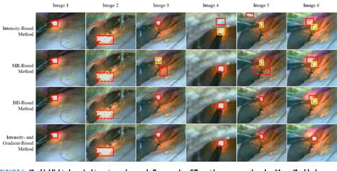 Figure 3 From Safety Enhanced Model Free Visual Servoing For Continuum Tubular Robots Through