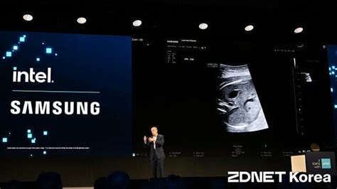 삼성메디슨 초음파 진단기 인텔 컴퓨텍스 기조연설에 등장 Zdnet Korea