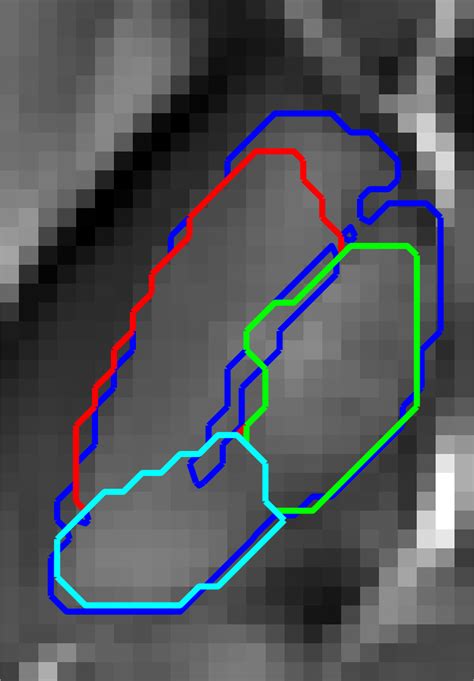 convex segmentation results for the n 116 template dataset from